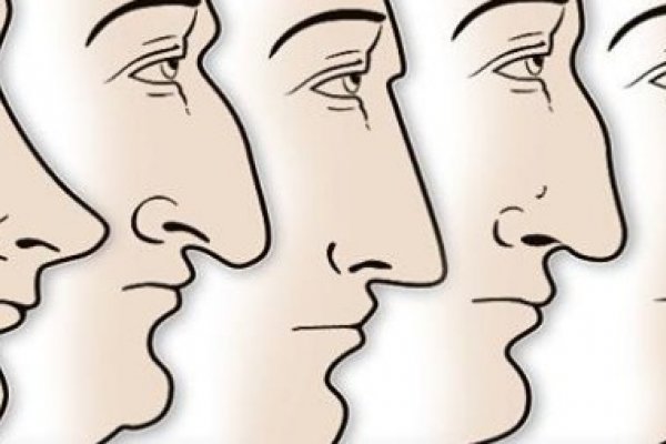 OBLIK NOSA OTKRIVA KAKVA STE OSOBA: Evo šta znači ako imate 'ORLOVSKI ...